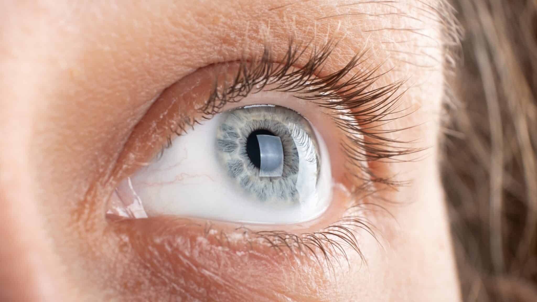 Common Signs of Diabetic Eye Disease - Milwaukee, WI